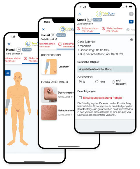 TeleScan - Das dermatologische Telekonsil